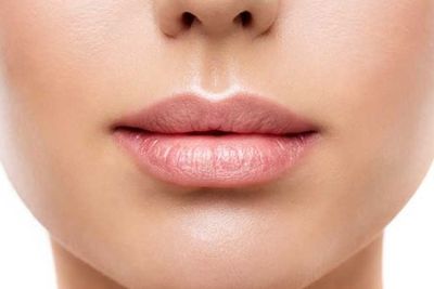 Mengenal Botox Lip Flip, Tren Bikin Bibir Lebih Berisi
