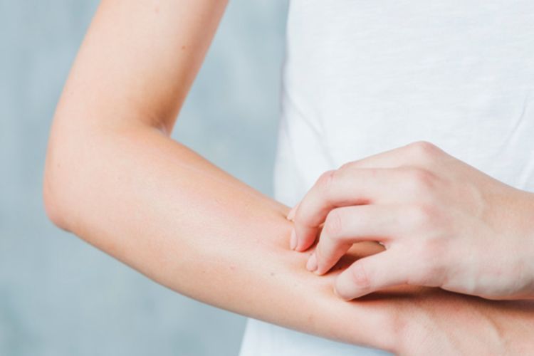 5 Gejala dan Penanganan Alergi Kulit Akibat Detergen